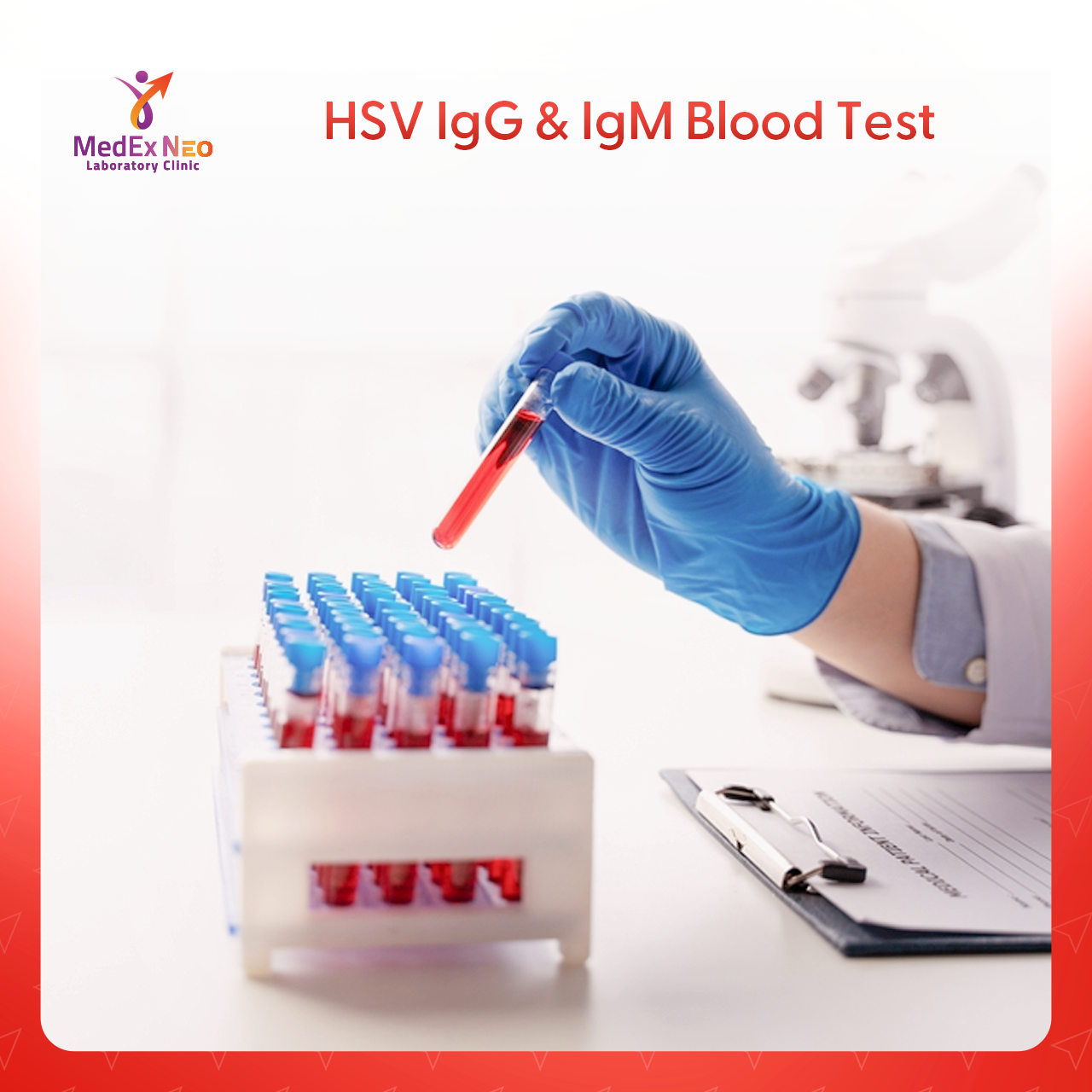 HSV IgG & IgM Blood Test - Medex