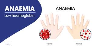 ANEMIA PROFILE BASIC - Medex